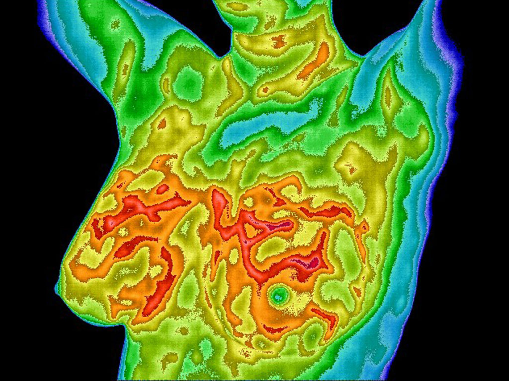 Thermogram of chest | Thermography Interpretation Services